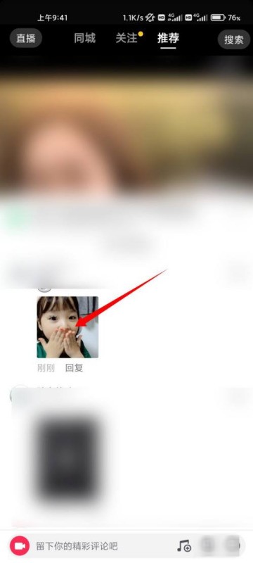 小米肿么看gif-ZOL问答
